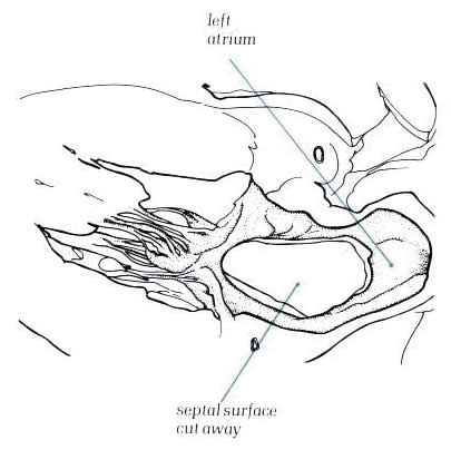 Anatomy of the Heart